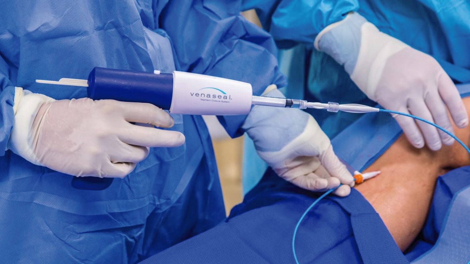 Diferentes grados de las varices, ¿cuál es el tuyo? ¡Descúbrelo!