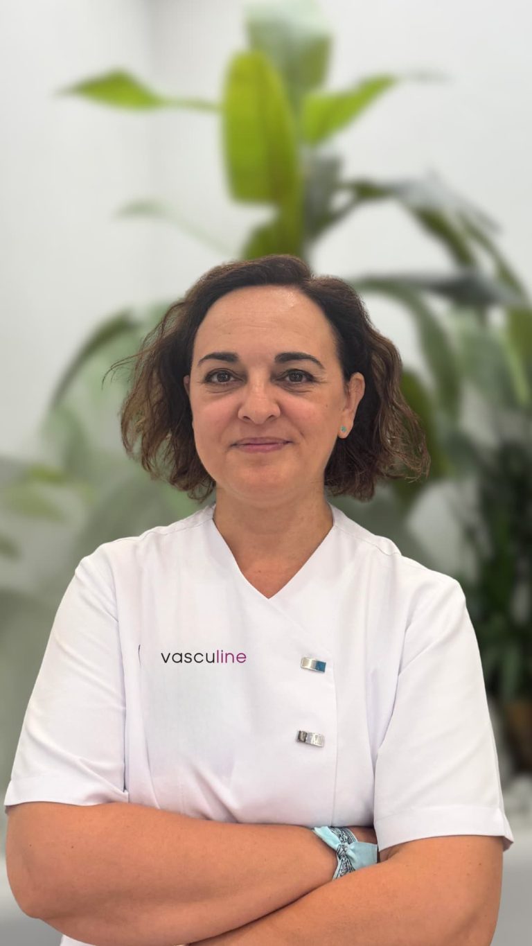 Diferentes grados de las varices, ¿cuál es el tuyo? ¡Descúbrelo!